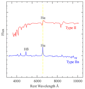 Type IIn Supernova | CAS CMS